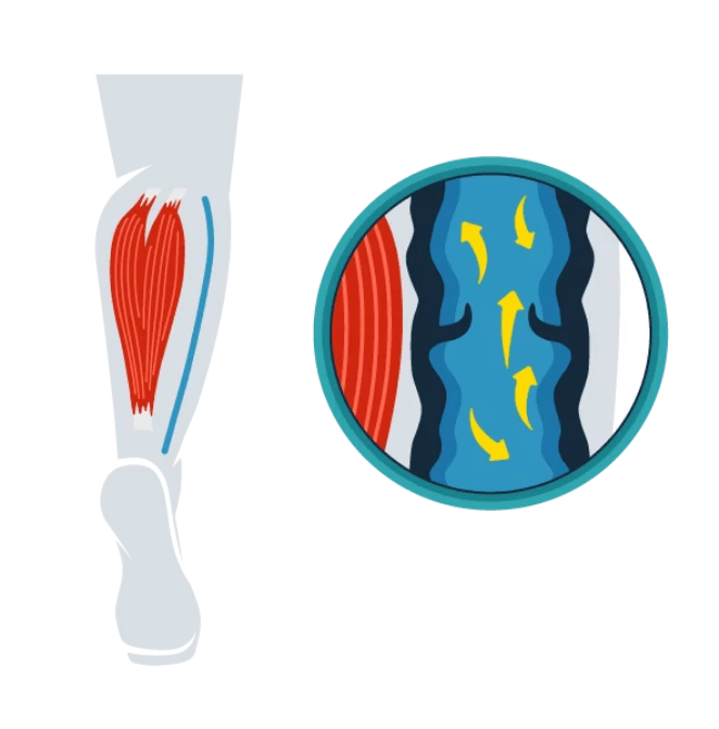 Science – Angeion Medical – Aerowrap